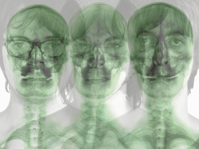 SUPERGRASS Announce Their Incredible Return With Dublin & Belfast Shows ...